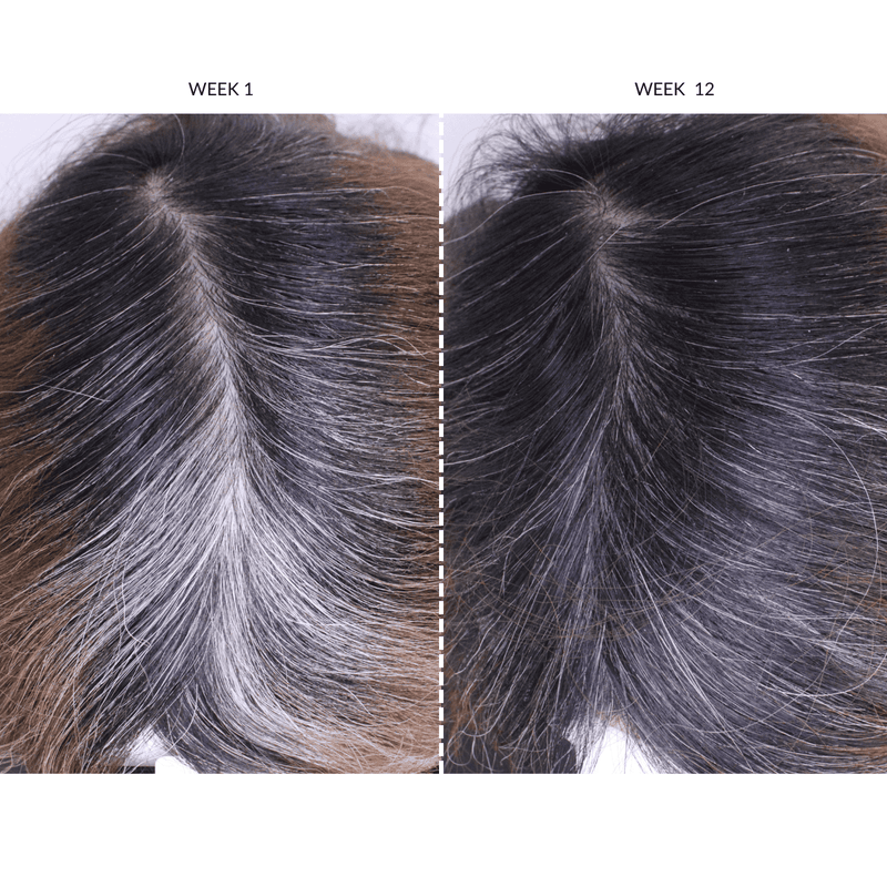 LED Hair Growth Helmet | Red Light Therapy for Hair Loss | CurrentBody ...